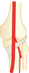 Appendicular Artery | Radiology Key