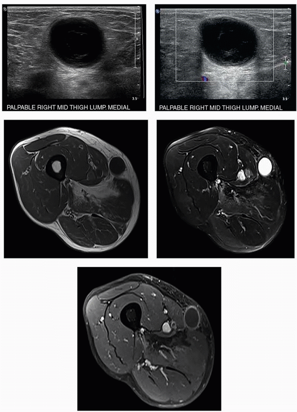 Musculoskeletal | Radiology Key