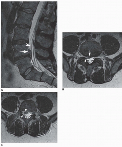 Radiologic Imaging Modalities | Radiology Key