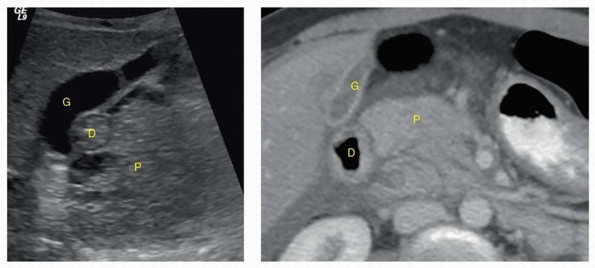 Pancreas, Spleen, and Bowel | Radiology Key
