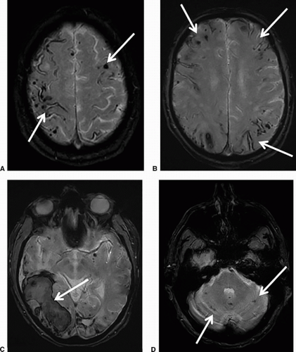 Vascular Abnormalities | Radiology Key