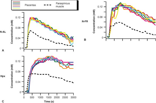 MR Relaxation Theory and Exchange Processes in the Presence of Contrast ...