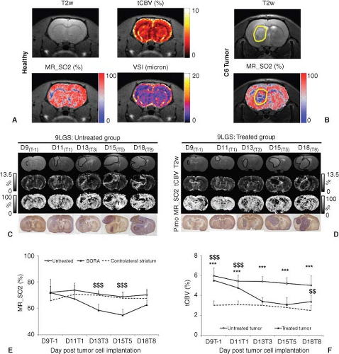 Oxygen Extraction Fraction (OEF) Imaging | Radiology Key