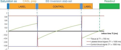 Readout and Background Suppression Techniques | Radiology Key