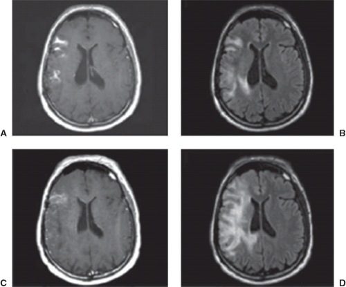 Predicting Prognosis, Therapy Selection, Guidance, and Treatment ...