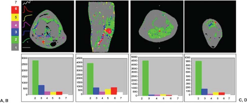Clinical Applications of Dynamic Contrast-Enhanced Magnetic Resonance ...