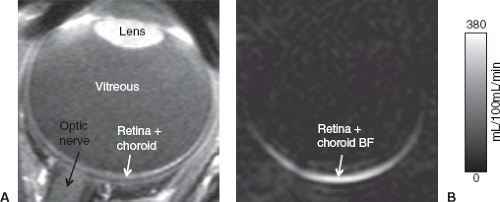 Retinal and Choroidal Blood Flow | Radiology Key