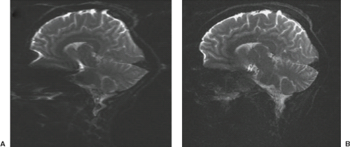 From Image Formation to Image Contrast: Understanding Contrast ...