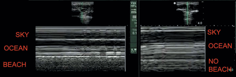 Chest | Radiology Key