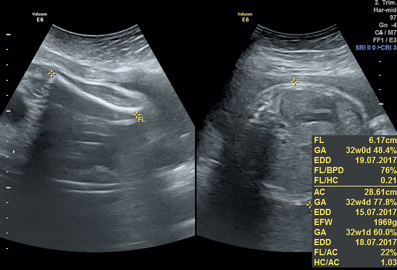 Third Trimester | Radiology Key