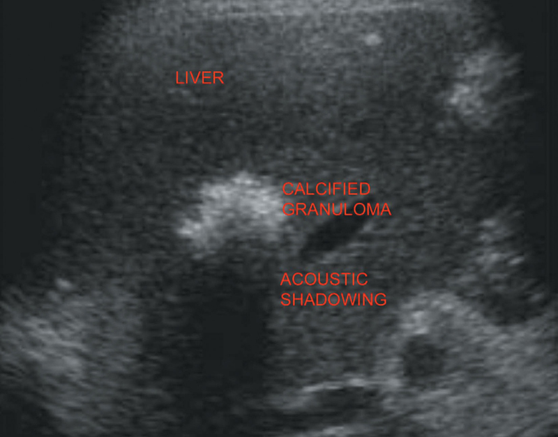 Liver | Radiology Key