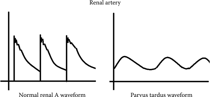Renal Doppler Radiology Key