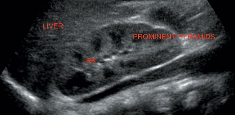 Genitourinary Tract, GUT | Radiology Key