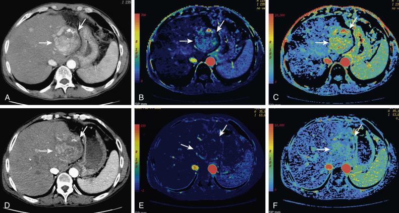 Recent Advances | Radiology Key