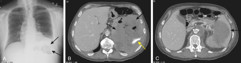 Mucosal Diseases of the Stomach: Differentiating Benign from Malignant ...