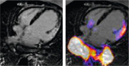 Positron emission tomography | Radiology Key