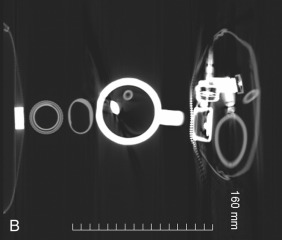 Cross-Sectional Imaging Techniques | Radiology Key