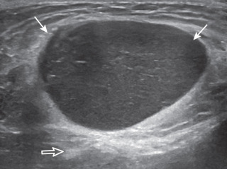 Elbow Ultrasound | Radiology Key