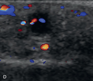 Wrist and Hand Ultrasound | Radiology Key