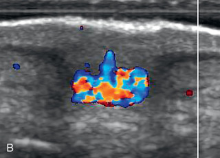 Ankle, Foot, and Lower Leg Ultrasound | Radiology Key