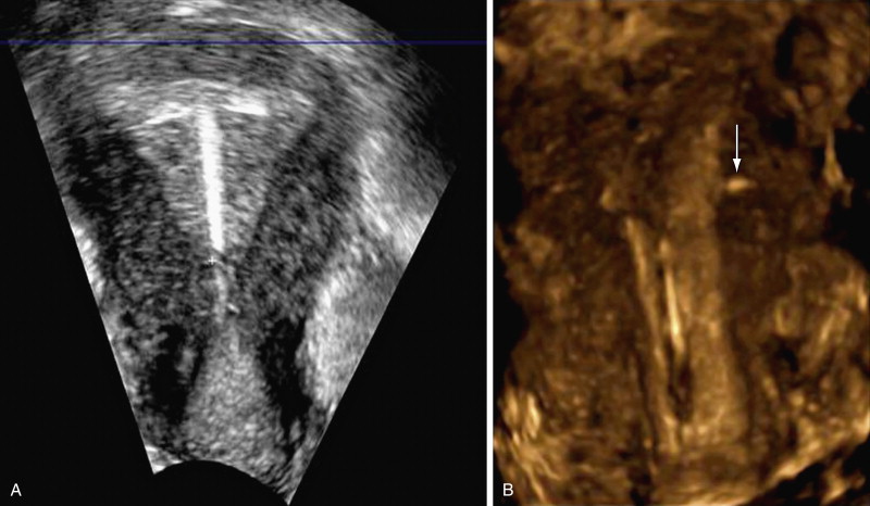 Approach to Pelvic Pain and the Role of Imaging | Radiology Key