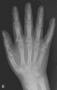 Magnetic Resonance Imaging | Radiology Key