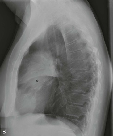 Segmental Anatomy | Radiology Key