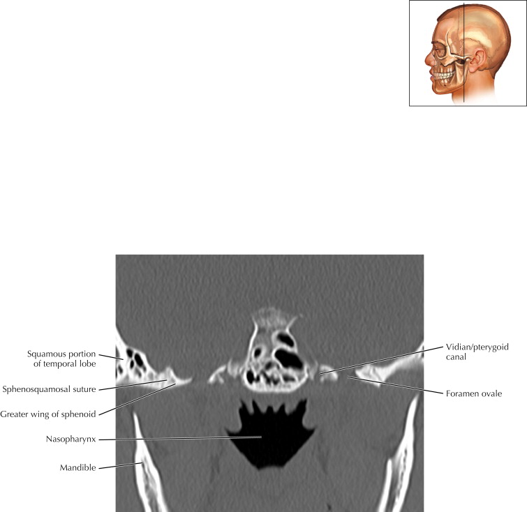 Mandible and Muscles of Mastication | Radiology Key