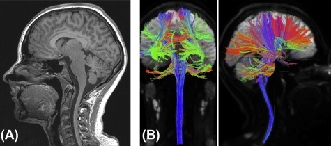 Array Coils | Radiology Key