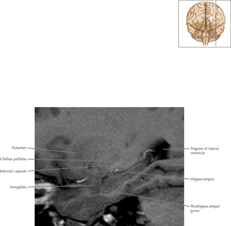 Limbic System | Radiology Key