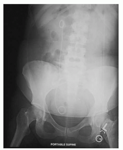 Urologic Procedures | Radiology Key