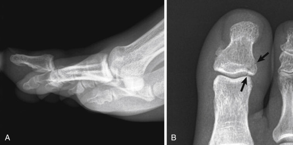 Lower Extremity | Radiology Key