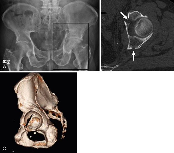 Pelvis | Radiology Key