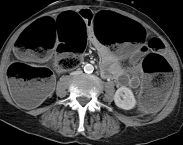 Gastrointestinal Tract | Radiology Key