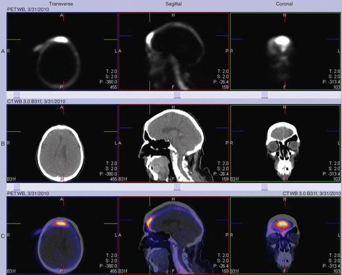 Instrumentation and Quality Control | Radiology Key