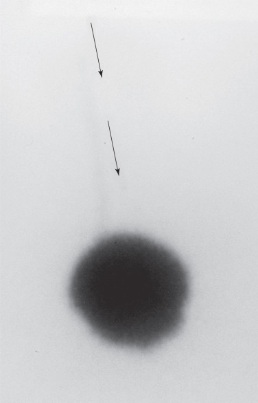 Central Nervous System | Radiology Key