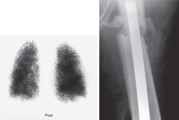 Respiratory System | Radiology Key