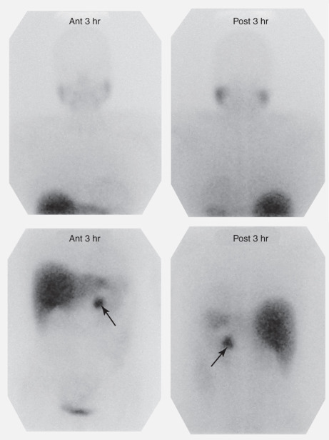 Genitourinary System and Adrenal Glands | Radiology Key