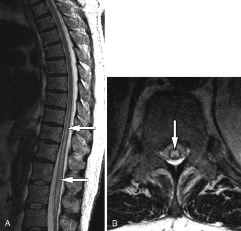 Post Radiation Effects | Radiology Key