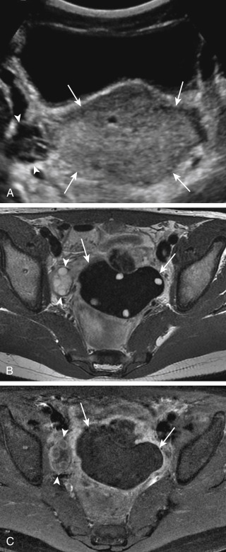 Genitourinary Radiology Key