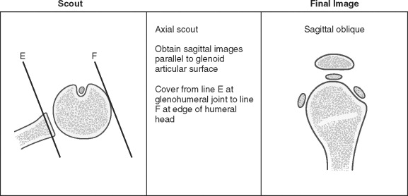 Shoulder | Radiology Key