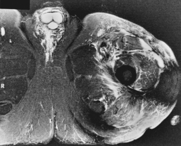 Tendons and Muscles | Radiology Key