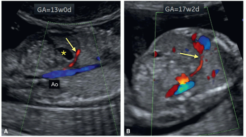 The Fetal Gastrointestinal System | Radiology Key