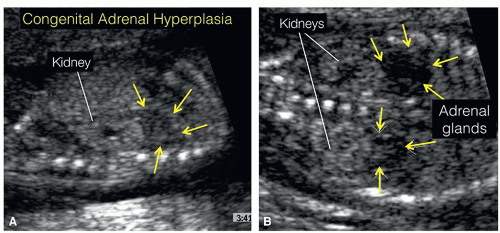 The Fetal Central Nervous System | Radiology Key