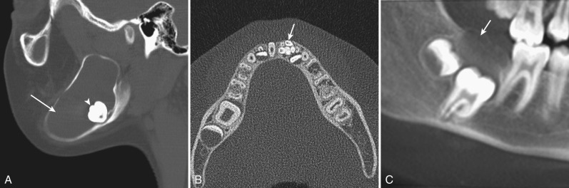 Head and Neck Imaging | Radiology Key