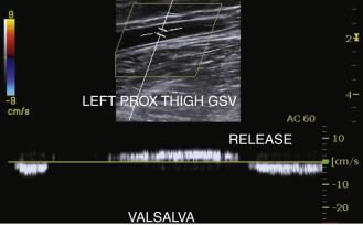 Extremity Venous Anatomy and Technique for Ultrasound Examination ...