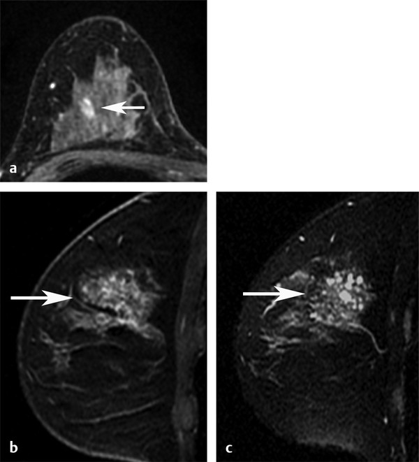 Interpretation Guidelines | Radiology Key