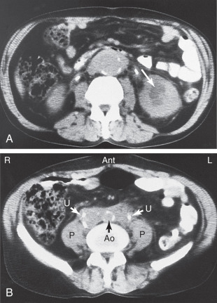 Genitourinary System and Retroperitoneum | Radiology Key
