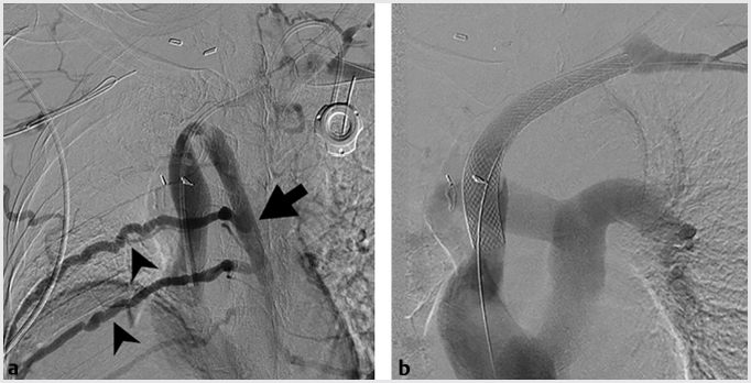 Venous Disease | Radiology Key