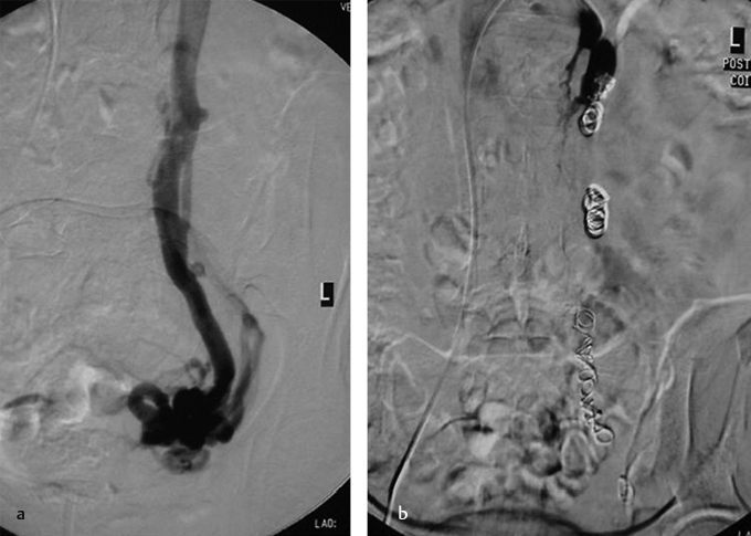 Genitourinary Disease | Radiology Key